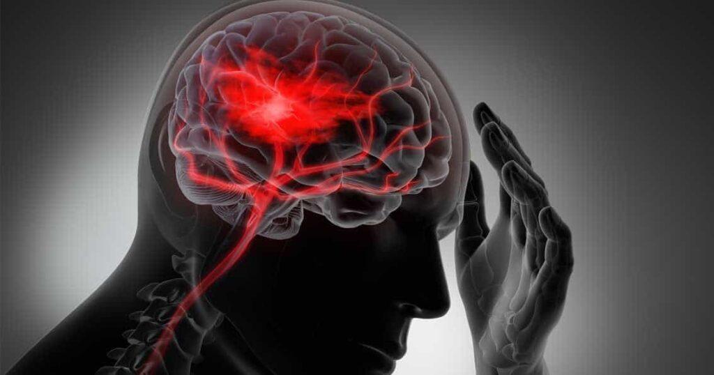 Cómo actuar ante un ictus - SID